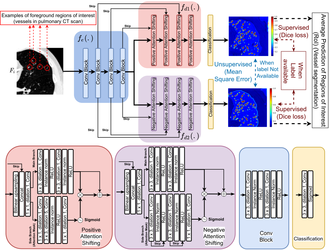 Learning Morphological Feature Perturbation for Semi-Supervised Segmentation | Satsuma